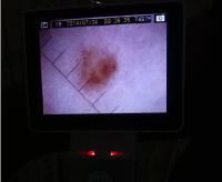 China Lcd Monitor Digital Video Otoscope Ophthalmoscope For Clinical Inspection Of Human Body for sale