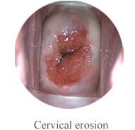 China Cervix Camera Video Camera for Vaginal Handheld Digital Mini Colposcope Self - Inspection with 1.5 Times Magnification for sale