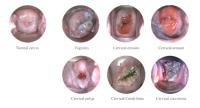 China Vaginal Camera for Women Care Digital Mini Colposcope 1.5 Times Magnification 10cm Observation Distance for sale