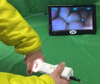China Self - Inspection Tool for Cervical Examination Digital Electronic Colposcope Applicable Individual Clinic and Hospital for sale