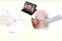 China Self - Inspection Tool for Cervical Examination Digital Electronic Colposcope Applicable Individual Clinic and Hospital for sale