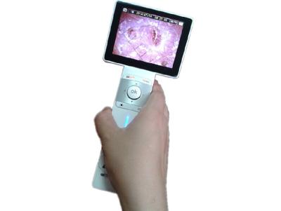 China 1920x1080 Digital Video Dermatoscope for sale