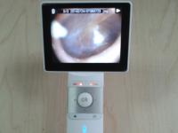 China Professional Digital Video Otoscope for sale
