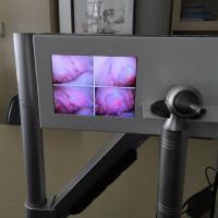 China Table Hook-wall Trolley Digital Video Otoscope for ENT with High Resolution 800 X 400 60mm 150mm 250mm Long Lens for sale
