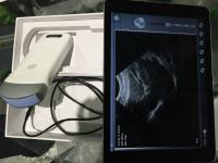 China Ipad Ultrasound Scanner Wireless Ultrasound Probe Only 308g Weight USB Connection for sale