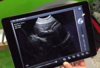 China Ipad Ultrasound Scanner Wireless Ultrasound Probe Only 308g Weight USB Connection for sale