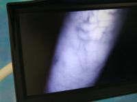 China Blood Testing Equipments Infrared Veinviewer For Hospital Use for sale