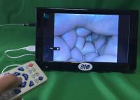 China Vaginal Camera Digital Electronic Colposcope to Find Disease of Cervix Eealier for sale