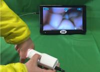 China Vaginal Camera Digital Electronic Colposcope to Find Disease of Cervix Eealier for sale
