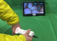 China Portable Digital Electronic Colposcope for sale