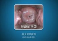 China Echo - Friendly Digital Electronic Colposcope Vaginal Camera / PAL Color System 20° Angle of Observation for sale