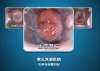 China Digital Endoscope Self-Inspect Colposcope for sale