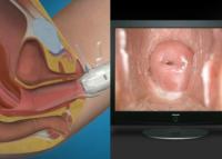 China Digital Endoscope Self-Inspect Colposcope for sale