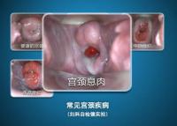 China AV USB output Digital Electronic Colposcope Self Inspection Device for Cervix And Vagin for sale