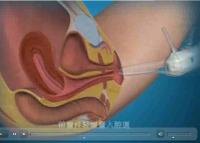 China AV USB output Digital Electronic Colposcope Self Inspection Device for Cervix And Vagin for sale