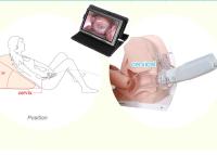 China High Definition Video Gynecological Apparatus Digital Electronic Colposcope AV/USB output for sale