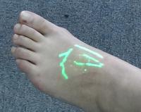 China High Contrast Image Vein Light Vein Locator Device For Medical Puncture by Projection for sale
