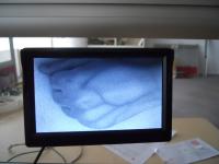 China High Resolution Vascular Image Infrared Vein Locator Device For Obese Patient for sale