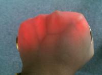 China No Radiation Strong Red Light  Infared Vein Finder With Mobile Rechargeable Battery for sale