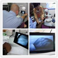 China Safe Light Source No Laser Vein Locator Device With High Resolution for sale