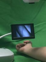 China Portable Dual head Infrared Vein Finder For Medical Illuminated Locator for sale