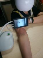China CE Medical Micro Device Infrared Vein Finder Without Laser for sale