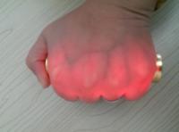 China Blood Analysis System Infared Vein Finder Lightweight No Radiation for sale