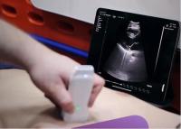 China Wifi Handheld Ultrasound Scanner Portable Convex Linear Cardiac Multifrequency 10MHz for sale