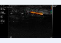 China 305mm Portable Handheld Ultrasound Scanner Probe Convex+Linear+Cardiac for sale