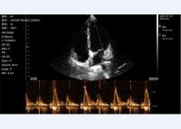 China Mobile Ultrasound Scanner Phased Array Probe Wireless Portable 3.6mhz 7.5/10mhz for sale