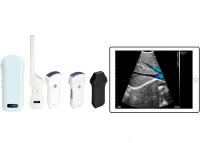 China Mobile Ultrasound Scanner Phased Array Probe Wireless Portable 3.6mhz 7.5/10mhz for sale