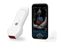 China 2.2MHz Mobile Portable Ultrasound Scanner Linear+Cardiac Probe  7.5/10MHz for sale