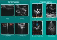 China 2.2MHz Mobile Portable Ultrasound Scanner Linear+Cardiac Probe  7.5/10MHz for sale