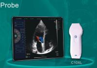 China 2.2MHz Mobile Portable Ultrasound Scanner Linear+Cardiac Probe  7.5/10MHz for sale