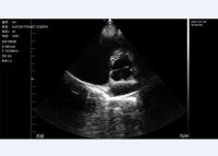 China 305mm Wifi Portable Ultrasound Bladder Scanner Convex+Linear+Cardiac Probe for sale