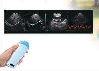 China Handheld Bladder Portable Scanner Micro Convex Probe Ultrasound Veterinary Pregnancy for sale