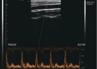 China Color Doppler Portable Pocket Ultrasound Scanner Application For MSK Breast Thyroid for sale
