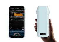 China Color Doppler Portable Pocket Ultrasound Scanner Application For MSK Breast Thyroid for sale