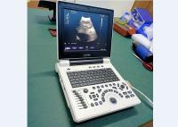 China Portable Handheld Ultrasound Scanner Handheld Bladder 5 Kinds Of Probes Available for sale
