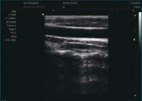 China 12MHz Color Doppler Ultrasound System Device With PW PDI Functions for sale