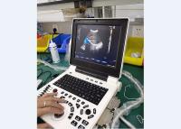China Portable Ultrasound Diagnostic Machine Laptop Probe Color Doppler Equipment for sale