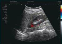 China Portable Ultrasound Diagnostic Machine Laptop Probe Color Doppler Equipment for sale