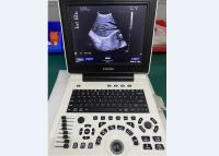 China Clarius Portable Ultrasound Clarius Ultrasound Scanner Color Doppler System 12