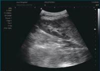 China Clarius Portable Ultrasound Clarius Ultrasound Scanner Color Doppler System 12