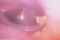 China Mini Portable Digital Video Otoscope Record Photographs / Videos For Ear Nose Checking for sale