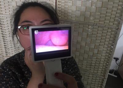 China ENT Endoscopy Rhinoscopy Medical Video Camera Digital Otoscope For Nose Checking With LCD Screen for sale
