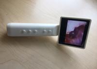 China Video USB AV Digital Otoscope Diagnostic Set Ear Camera For Ear Inspection for sale