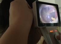 China ENT Endoscope Digital Video Otoscope Full Digital Inspection With SD Card Output USB Otoscope for sale