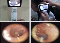 China 1920 x 1080 pixels CMOS Smart Medical USB Video Otoscope For Ear Skin And General Imaging for sale