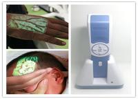 China Handheld Vein Iocator Safe Material Vein Finder Clear Accurate Intuitive with 850nm Wavelengths for sale